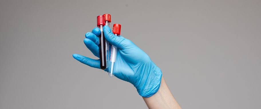 Podwyższone monocyty – o czym świadczą, norma, interpretacja wyniku ...